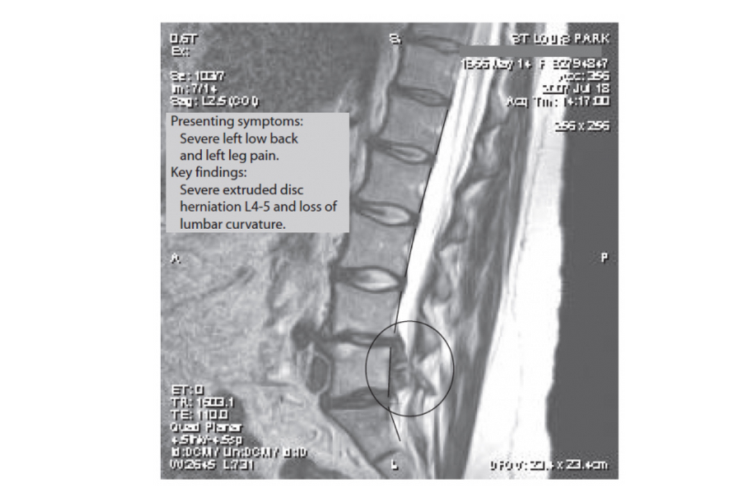 The DMR Method - Hopkins Health & Wellness Center – Hopkins Health and ...